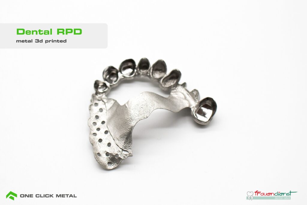 Metal 3D Printing for Dental Applications