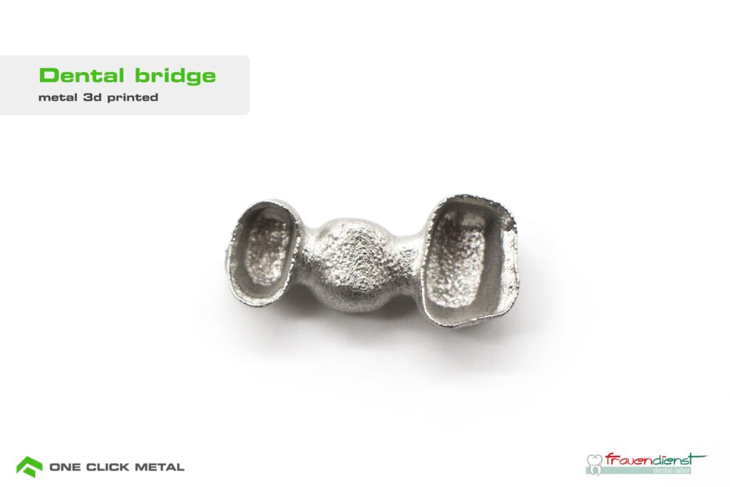 Metal 3D Printing for Dental Applications