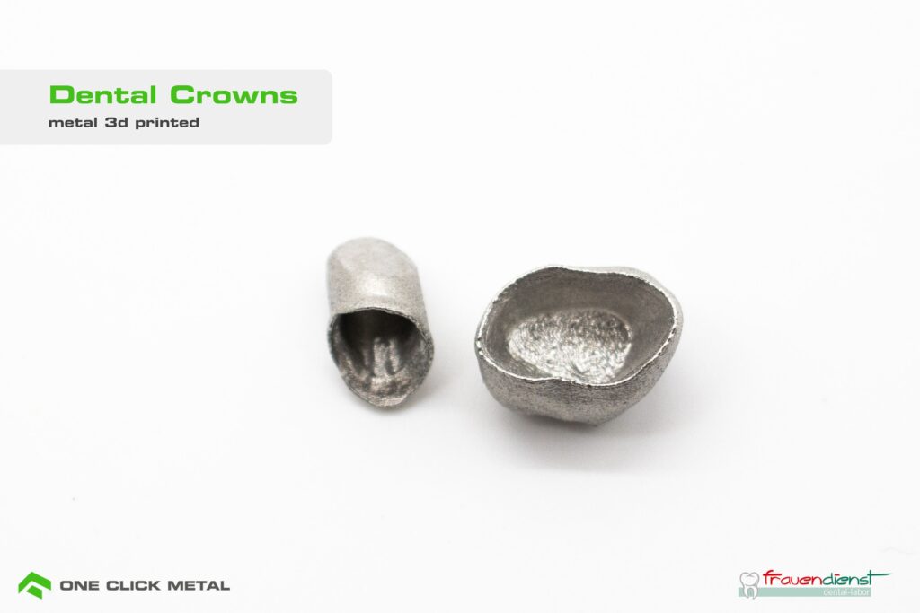 Metal 3D Printing for Dental Applications